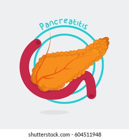 Pancreas Vector Illustration Stock Vector (Royalty Free) 603333227 ...