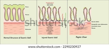The best free Pathophysiology drawing images. Download from 6 free ...