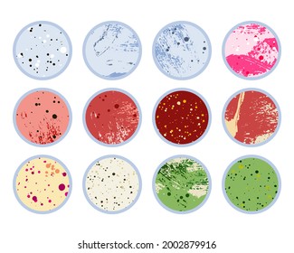 154 Agar plates with colonies Stock Vectors, Images & Vector Art ...