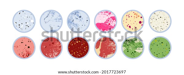 Petri dish, plate with agar, bacterial colony. Bacteriology ...