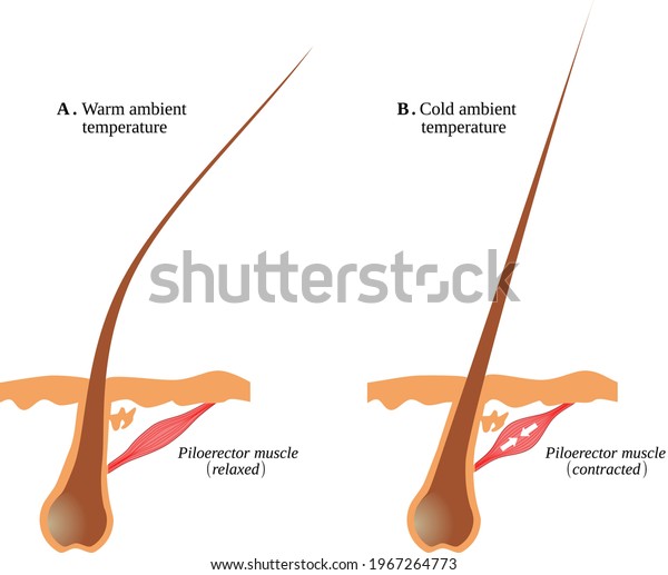 Piloerection Erection Bristling Hairs Stock Vector (Royalty Free ...