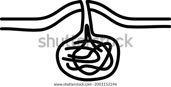 Pilonidal Cyst Icon Vector Illustration Stock Vector (Royalty Free ...