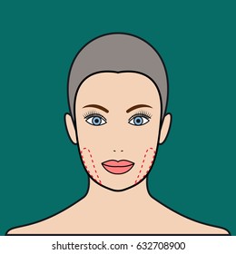 13 Buccal fat pad Images, Stock Photos & Vectors | Shutterstock