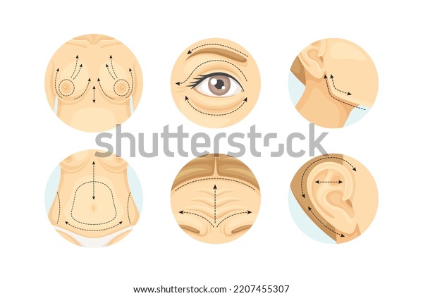 Plastic Surgery Restoration Reconstruction Human Body Stock Vector ...