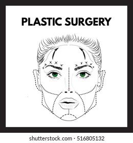 Plastic Surgery Vector Illustration Stock Vector (Royalty Free ...
