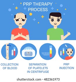 Platelet Rich Plasma Injection Procedure Prp Stock Vector (Royalty Free ...