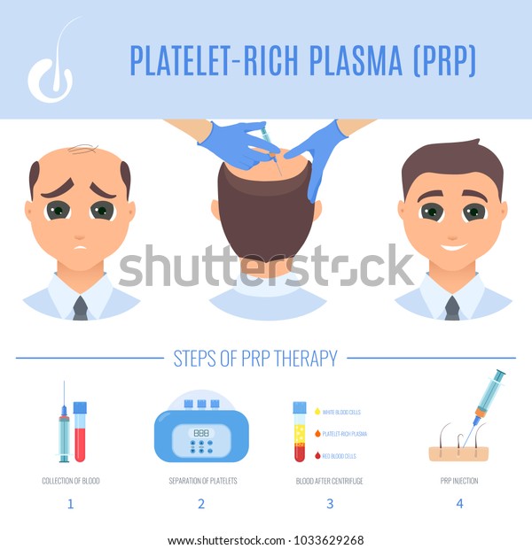 Platelet Rich Plasma Injection Procedure Prp Stock Vector (Royalty Free ...