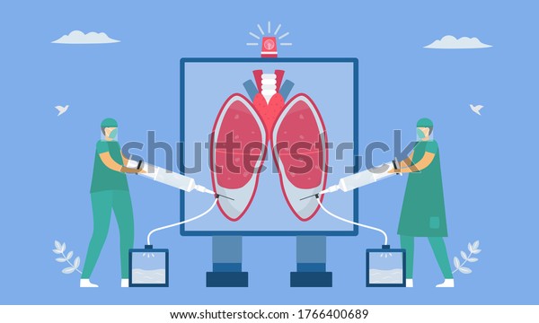 Pleural Effusion Collection Excess Fluid Between Stock Vector (Royalty ...