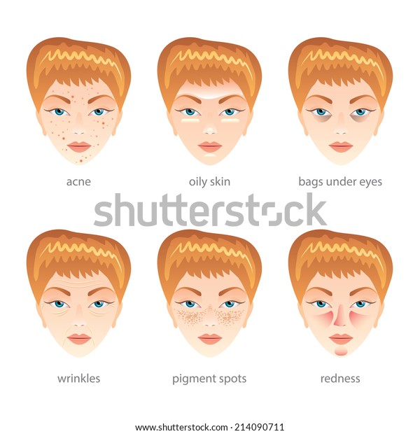 Problem Skin Different Face Diseases Vector Stock Vector (Royalty Free ...