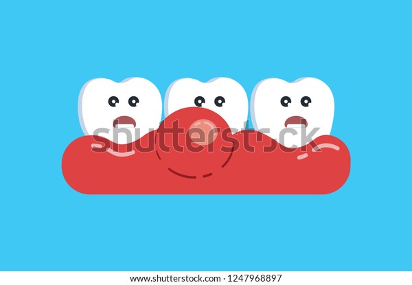 Problems Oral Cavity Swelling Tumors Gum Stock Vector (Royalty Free ...