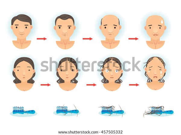 Process Hair Loss Cartoon Vector Illustration Stock Vector (Royalty ...