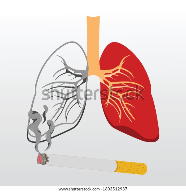 Professional Creative Design Lungs Smoking Non Stock Vector (Royalty ...