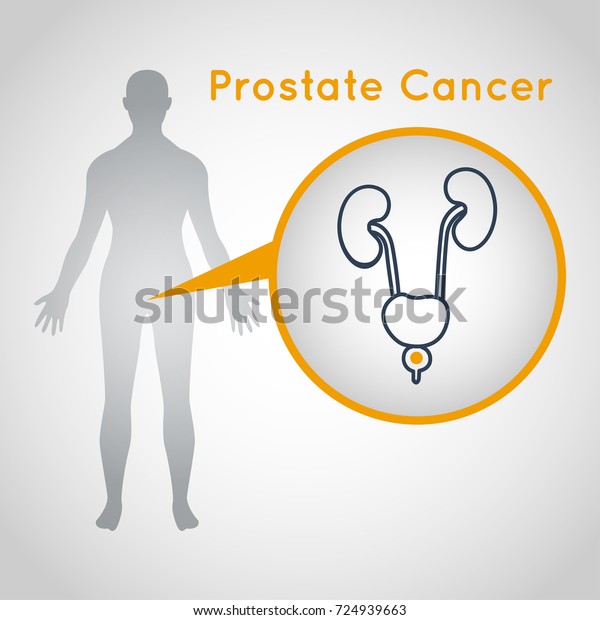 Prostate Cancer Vector Logo Icon Illustration Stock Vector (Royalty ...