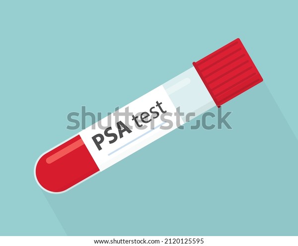 Psa Test Tube Blood Sample Vector: เวกเตอร์สต็อก (ปลอดค่าลิขสิทธิ์ ...