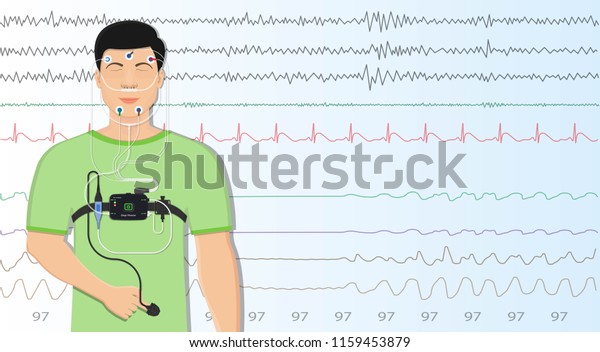Psg Sleep Study Test Apnea Diagnose Stock Vector (Royalty Free) 1159453879
