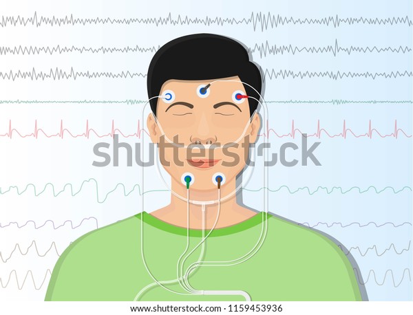 Psg Sleep Study Test Apnea Diagnose Stock Vector (Royalty Free) 1159453936