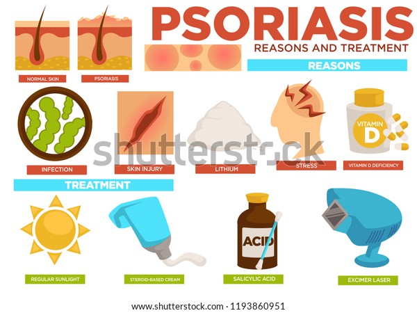 Psoriasis Reasons Treatment Poster Info Vector Stock Vector Royalty