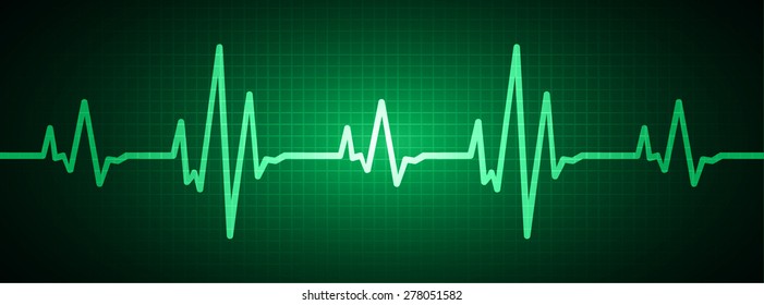 Ekg Heartbeat On Monitor Recording Pulse Stock Photo (Edit Now) 754669813