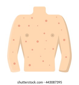 609 Scabies skin human Images, Stock Photos & Vectors | Shutterstock