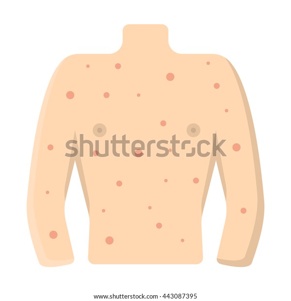 Rash Icon Cartoon Stock Vector (Royalty Free) 443087395