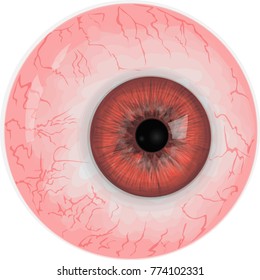 Red Eyeball Causes