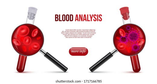 Realistic Vector Illustration Blood Analysis Test Stock Vector (Royalty ...
