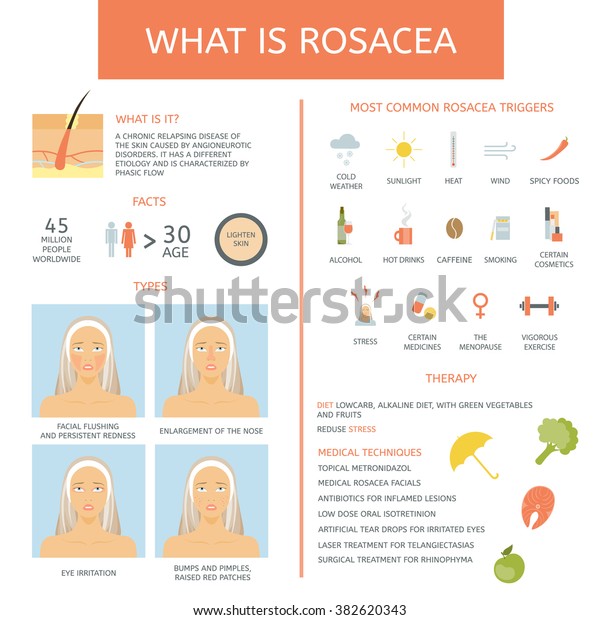 Rosacea Causes Types Therapy Facts Infographics Stock Vector (Royalty ...