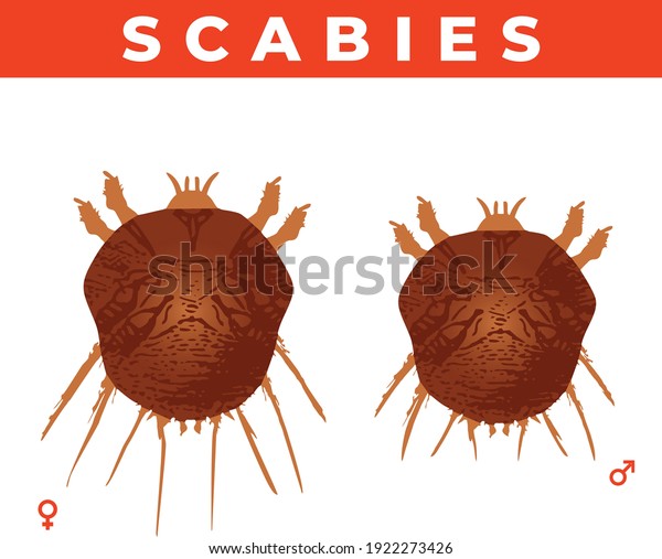 Scabies Vector Infographics Illustration On Isolated Stock-vektor ...