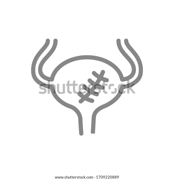 Scar On Urinary Bladder Line Icon Stock Vector (Royalty Free) 1709220889
