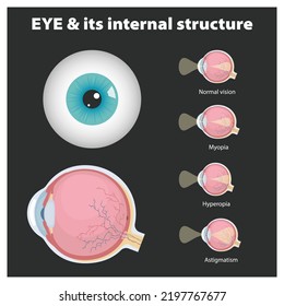 Scientific Illustration Internal Eye Stock Vector (Royalty Free ...