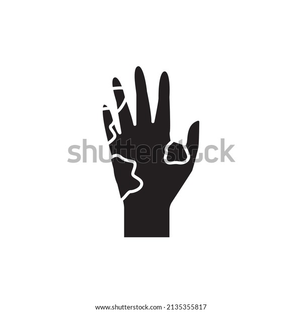 Scleroderma Color Line Icon Pictogram Web Stock Vector (Royalty Free ...