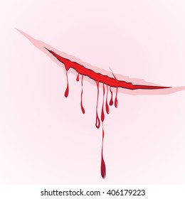 Scratch blood 26,128 รายการ ภาพ ภาพสต็อกและเวกเตอร์ | Shutterstock