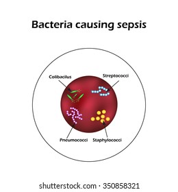 Septicaemia Images, Stock Photos & Vectors | Shutterstock