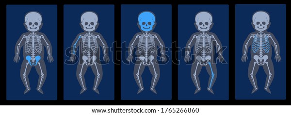Set Human Child Skeleton Anatomy Front Stock Vector (Royalty Free ...