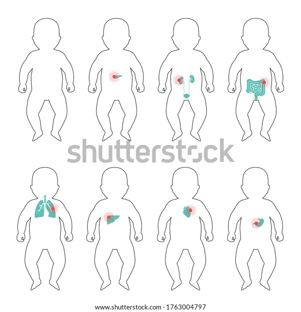 Set Vector Isolated Illustration Pain Inflammation Stock Vector ...