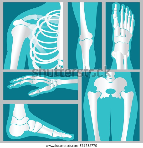 Set Xray Human Emblem Sign Medical Stock Vector (Royalty Free ...