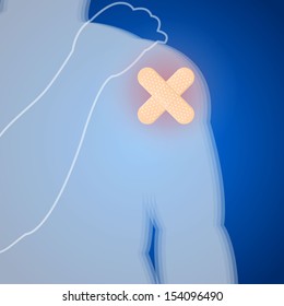 Shoulder Injuries On Blue Background Illustration Stock Vector (Royalty ...
