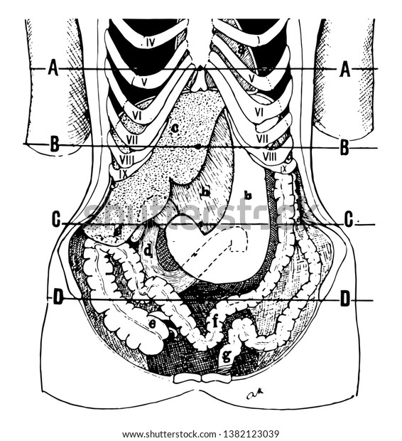 Showing Position Viscera Condition Visceroptosis Vintage Stock Vector ...