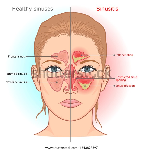 3.026 Sinus diagram Görseli, Stok Fotoğraflar ve Vektörler | Shutterstock