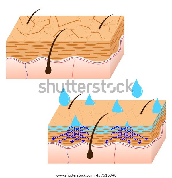 Skin hydration and dry skin sectional view vector illustration.
