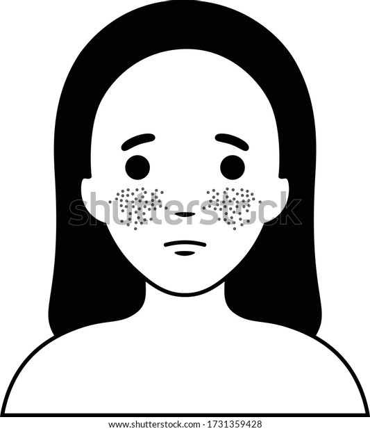 Skin Problem Allergic Rashes Minimal Line Stock Vector (Royalty Free ...