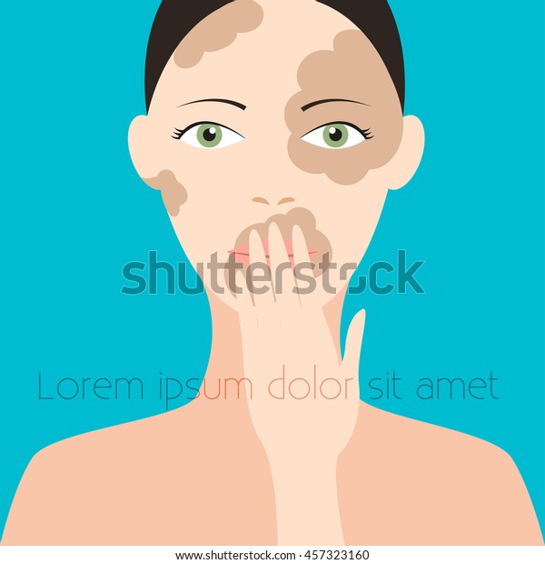 Skin Problems Vector Illustration Girl Suffering Stock Vector (Royalty ...