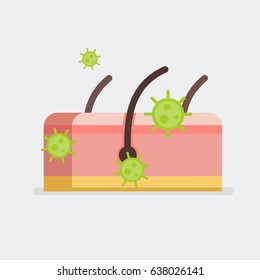 Skin Vector Illustration Virus: เวกเตอร์สต็อก (ปลอดค่าลิขสิทธิ์ ...