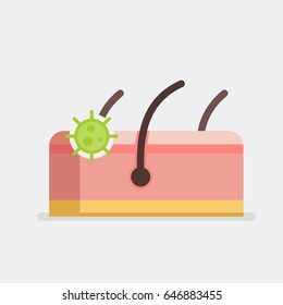 Skin Vector Illustration Virus Stock Vector (Royalty Free) 646883455 ...