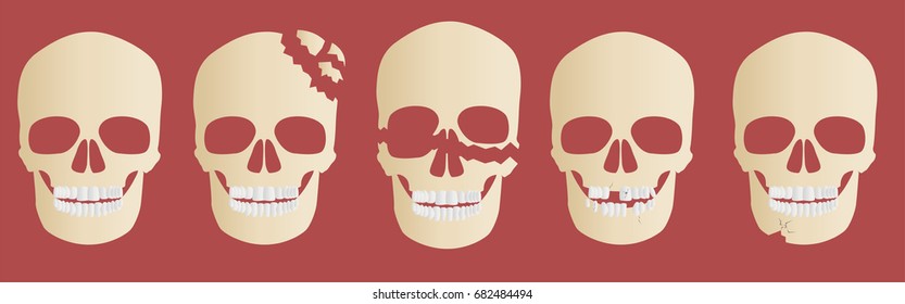 Skull Bone Crack Vector Head Stock Vector (Royalty Free) 682484494 ...