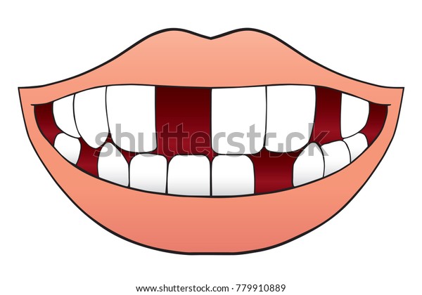 444 Missing Tooth Cartoon Images, Stock Photos & Vectors | Shutterstock
