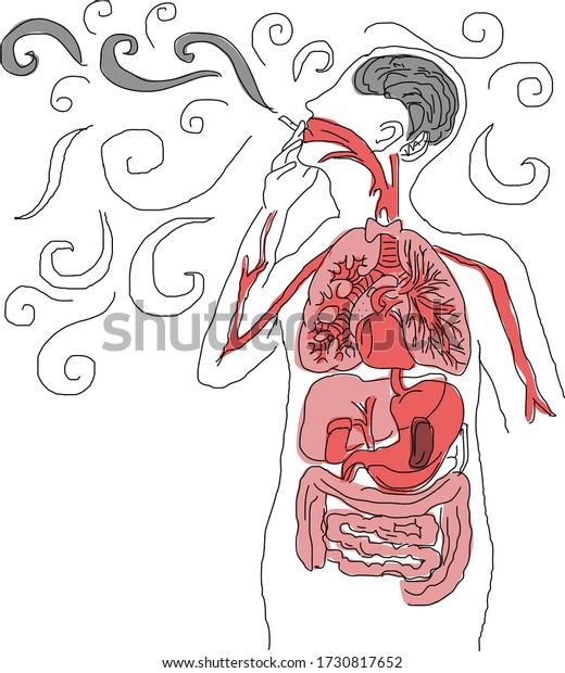 Smoking Human Body Freehand Vector Drawing Stock Vector (Royalty Free ...