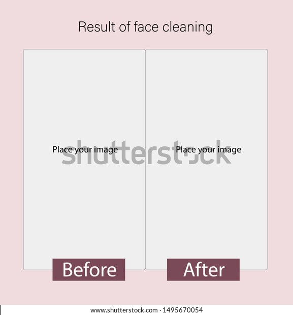 Social Media Post Before After Vector Stock Vector (Royalty Free ...