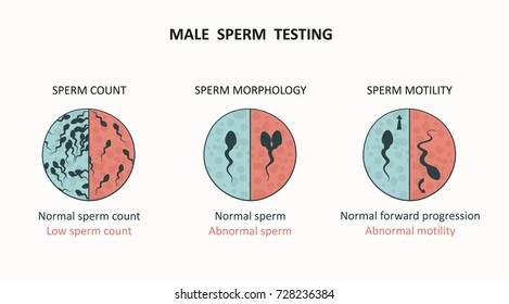 Spermogram Images, Stock Photos & Vectors | Shutterstock