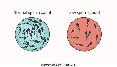 Spermogram Number Spermatozoa Stock Vector (Royalty Free) 728185540 ...